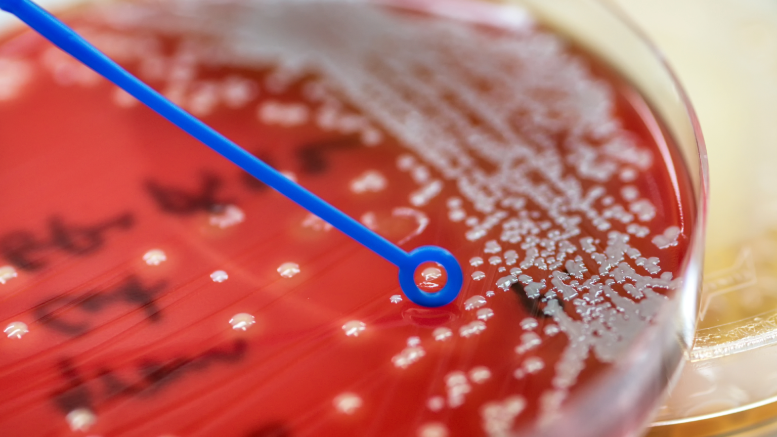 Automated Microbiology Streaking: Navigating Anaerobic Bacteria - Oxyrase